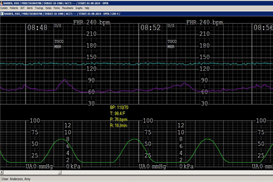 OBIX Plugin for Allscripts App Expo